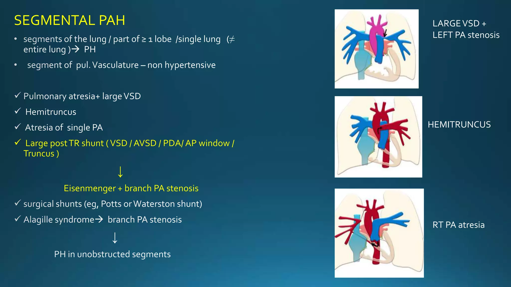 Eisenmenger syndrome | PPTX