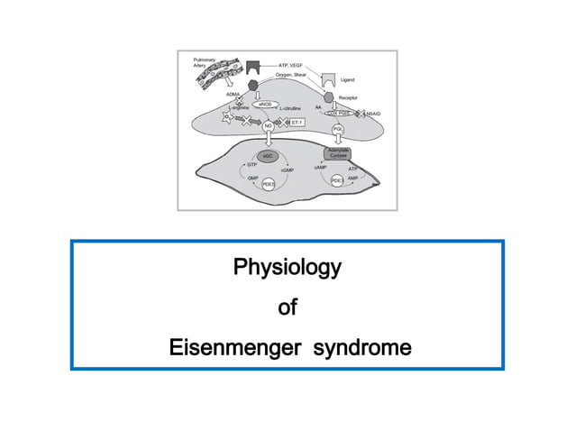 Eisenmenger syndrome - physiology and evaulation of eisenmenger’s ...