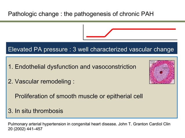 Eisenmenger syndrome - physiology and evaulation of eisenmenger’s ...