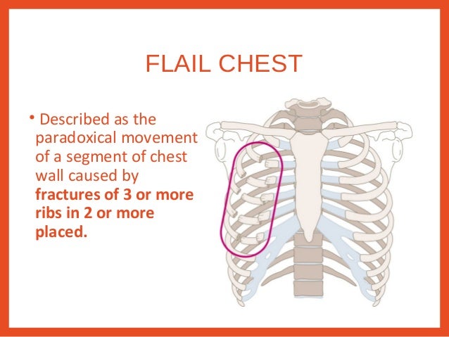 Resuscitation and thoracic trauma