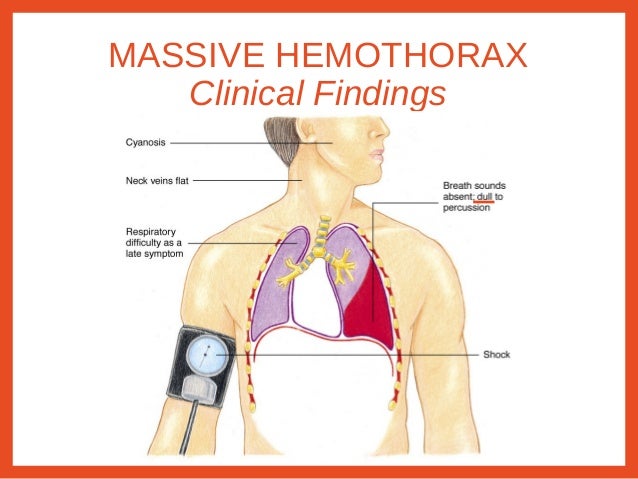 Resuscitation and thoracic trauma