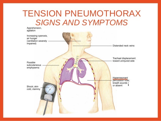 Resuscitation and thoracic trauma
