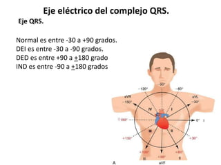Eje eléctrico del complejo QRS. | PPTX