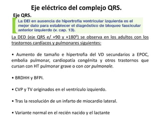 Eje eléctrico del complejo QRS. | PPTX