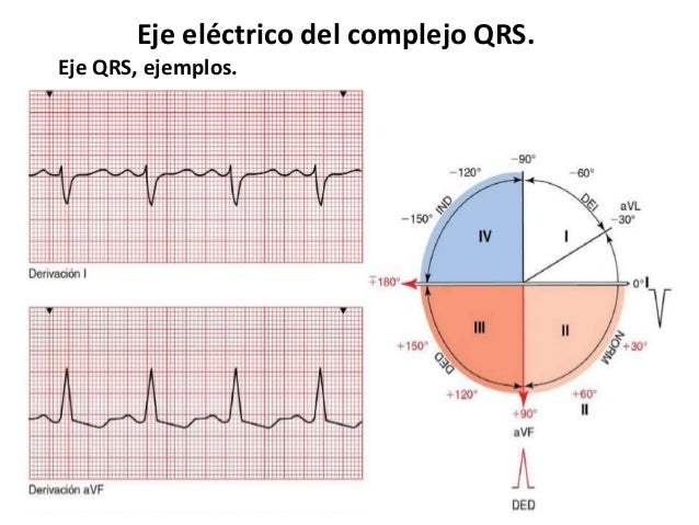 Eje eléctrico del complejo QRS.