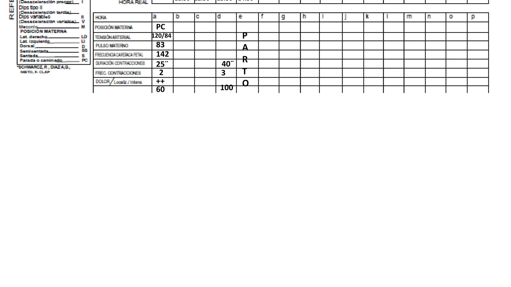 EJEMPLOS DE PARTOGRAMA PARA REPASAR.pptx