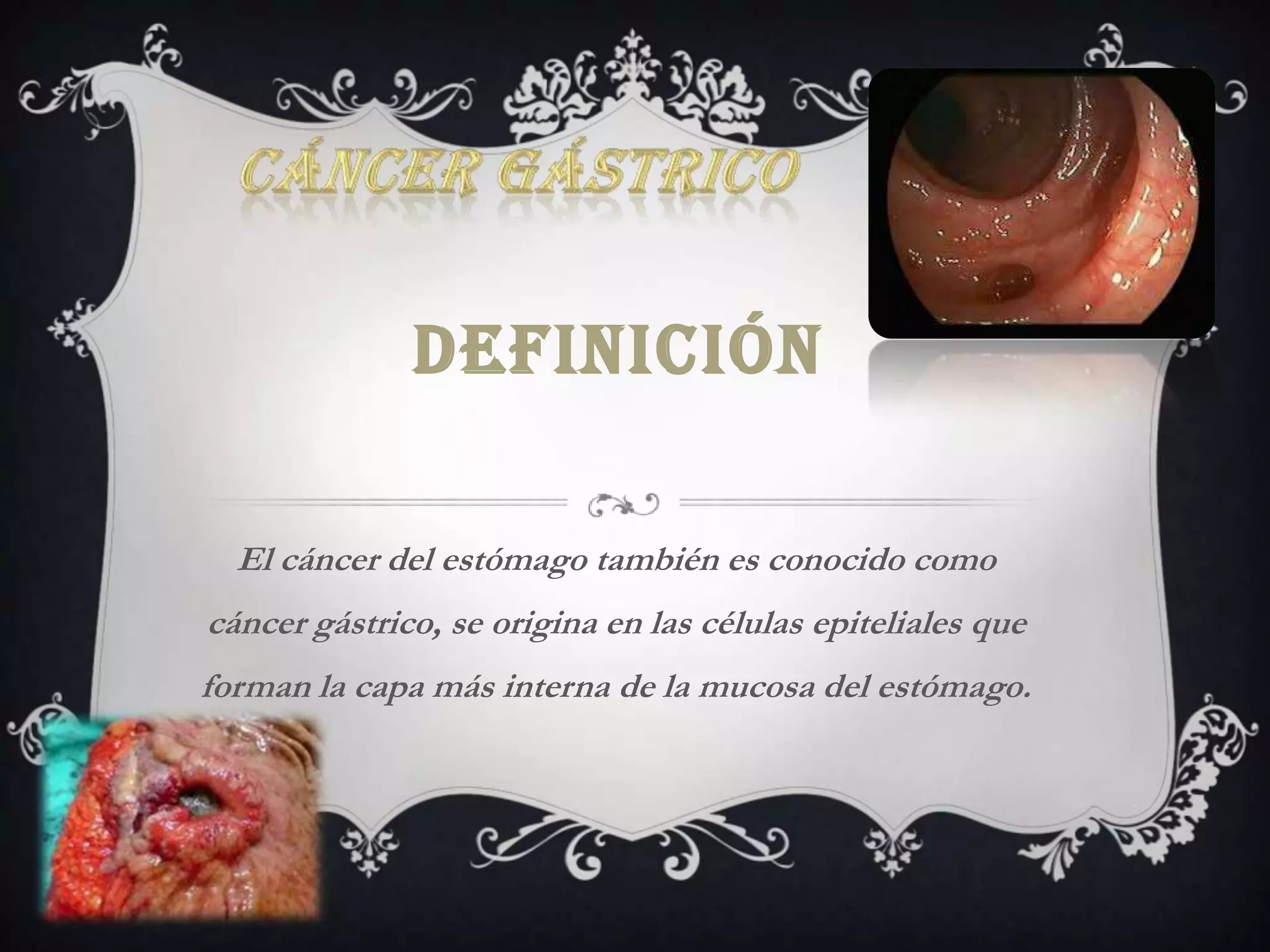 Ejemplos diapo | PPTX | Cancer | Diseases and Conditions