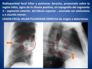 Ejemplos radiológicos III 18 Nov 2022.pdf