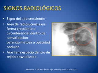 Ejemplos radiológicos III 18 Nov 2022.pdf