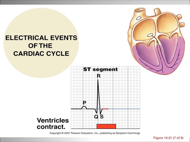 Curso de EKG básico | PPT