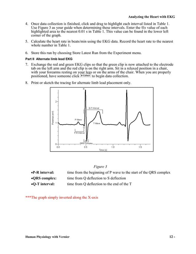 Ekg | PDF