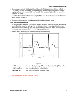 Ekg | PDF