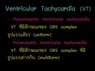การอ่านค่า Ekg | PDF