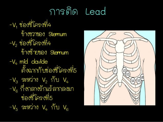 การอ่านค่า Ekg