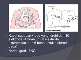 Ekg | PPTX
