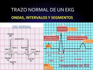 ECG EN ENFERMERIA | PPTX