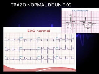 ECG EN ENFERMERIA | PPTX