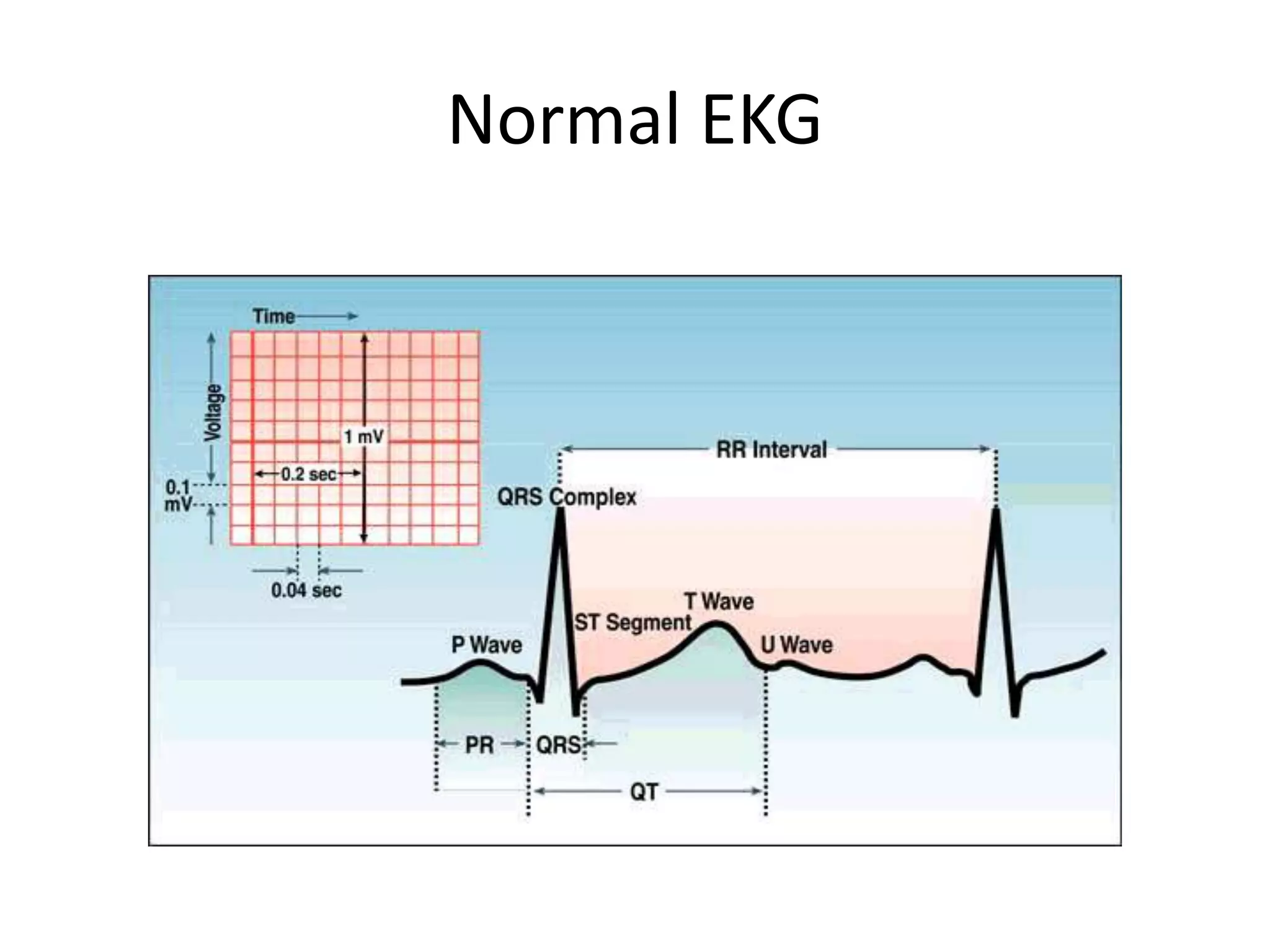 EKG 海大.pptx