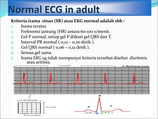 ekg.pptx