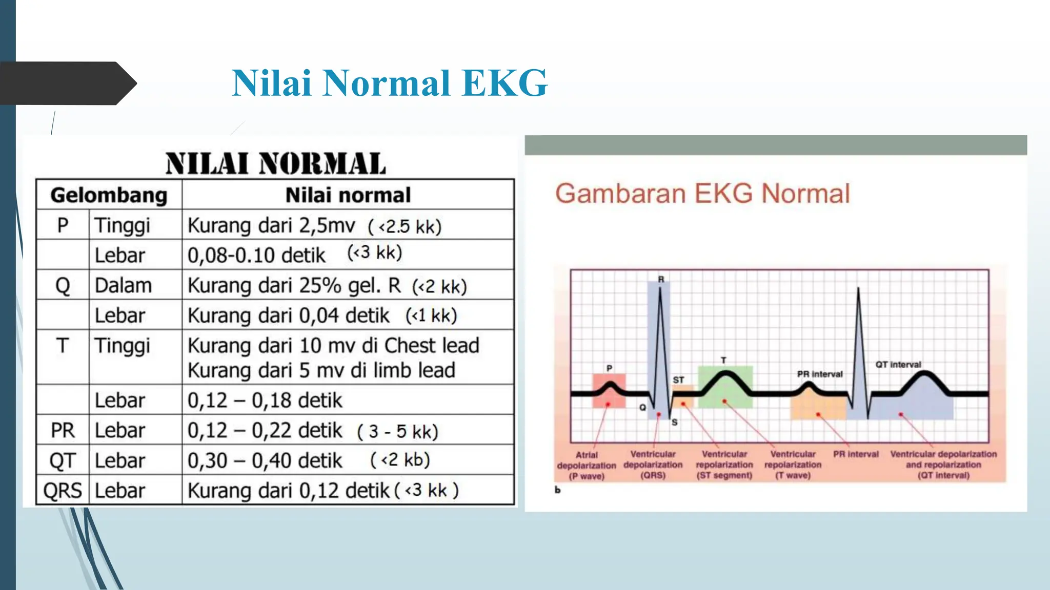 Cara membaca EKG dengan baik dan benar, untuk tenaga kesehatan | PPT