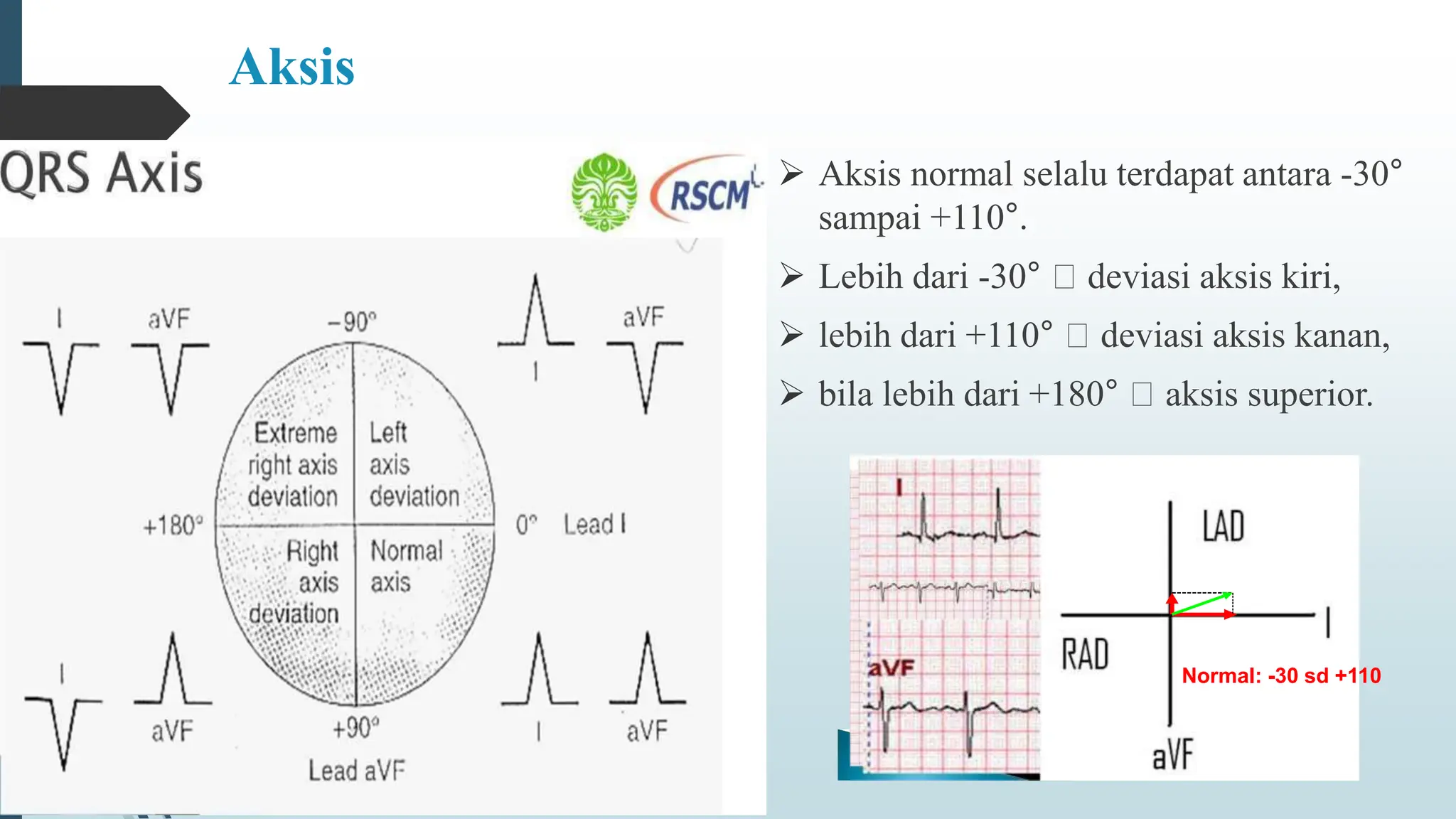 Cara membaca EKG dengan baik dan benar, untuk tenaga kesehatan | PPT