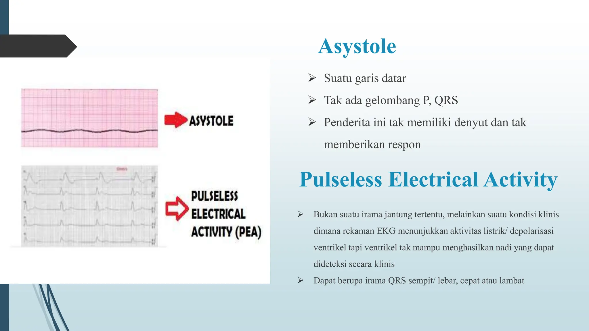 Cara membaca EKG dengan baik dan benar, untuk tenaga kesehatan | PPT