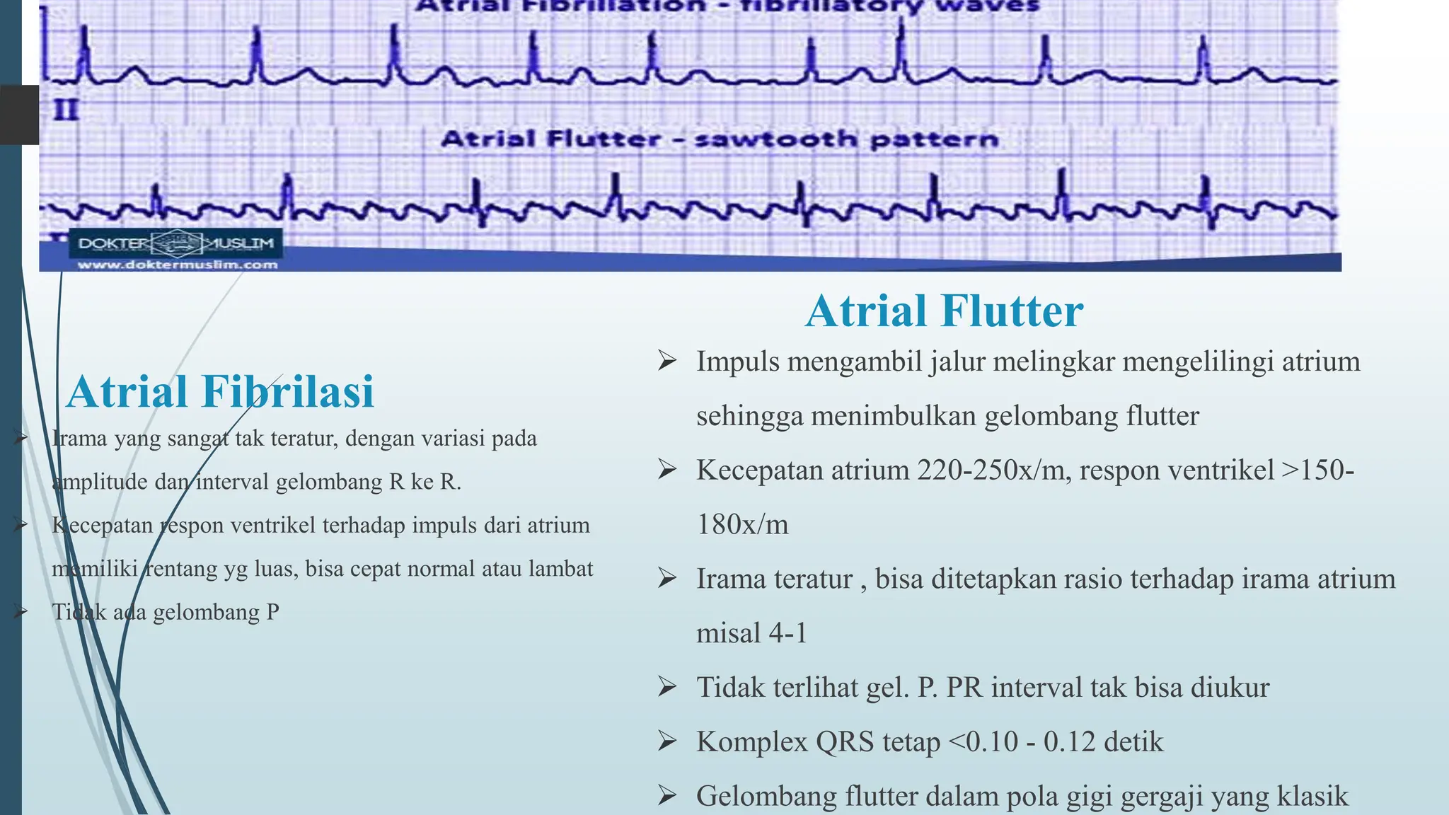 Cara membaca EKG dengan baik dan benar, untuk tenaga kesehatan | PPT