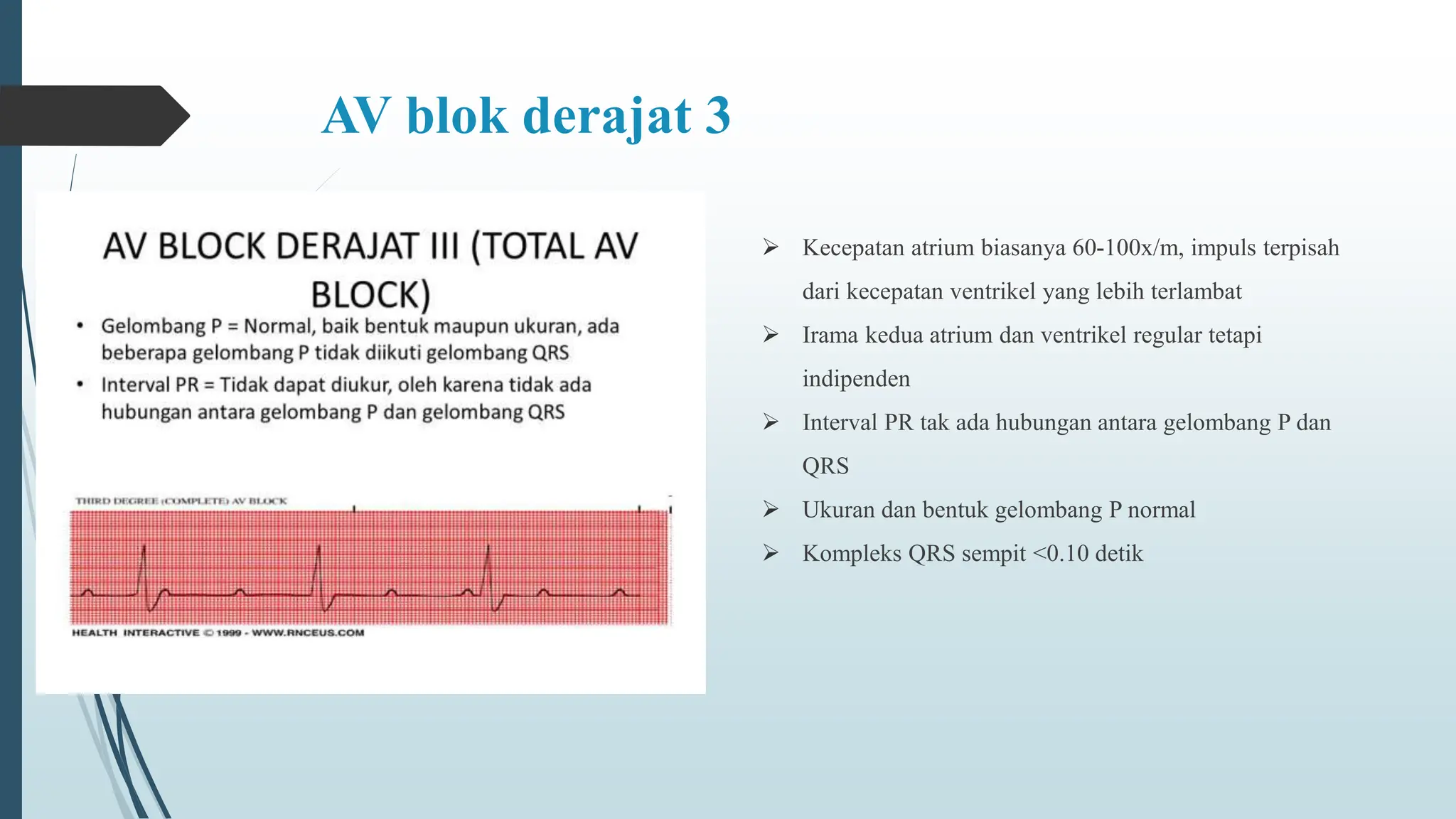 Cara membaca EKG dengan baik dan benar, untuk tenaga kesehatan | PPT