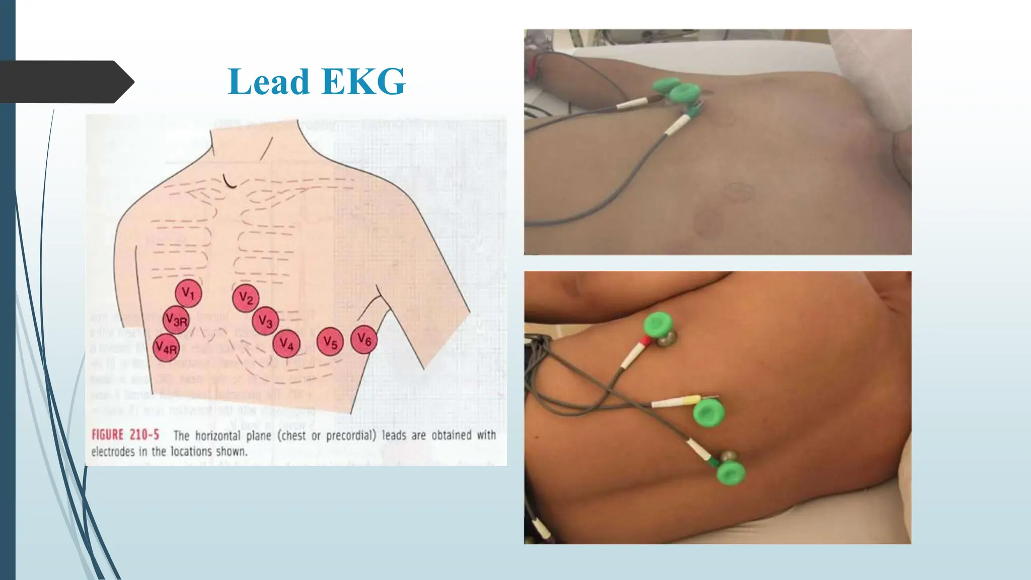 Cara membaca EKG dengan baik dan benar, untuk tenaga kesehatan | PPT