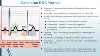 Cara membaca EKG dengan baik dan benar, untuk tenaga kesehatan | PPT