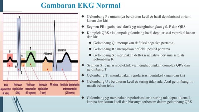 Cara membaca EKG dengan baik dan benar, untuk tenaga kesehatan | PPT