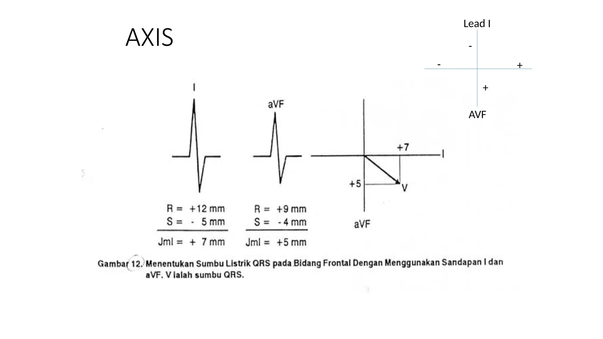 EKG pemasangan elektro kardio graf .pptx