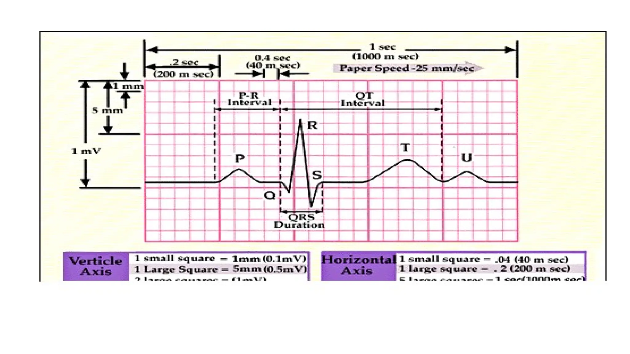 EKG pemasangan elektro kardio graf .pptx