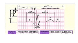 EKG pemasangan elektro kardio graf .pptx