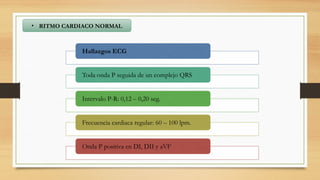 Lectura del electrocardiograma normal y arritmias | PPTX