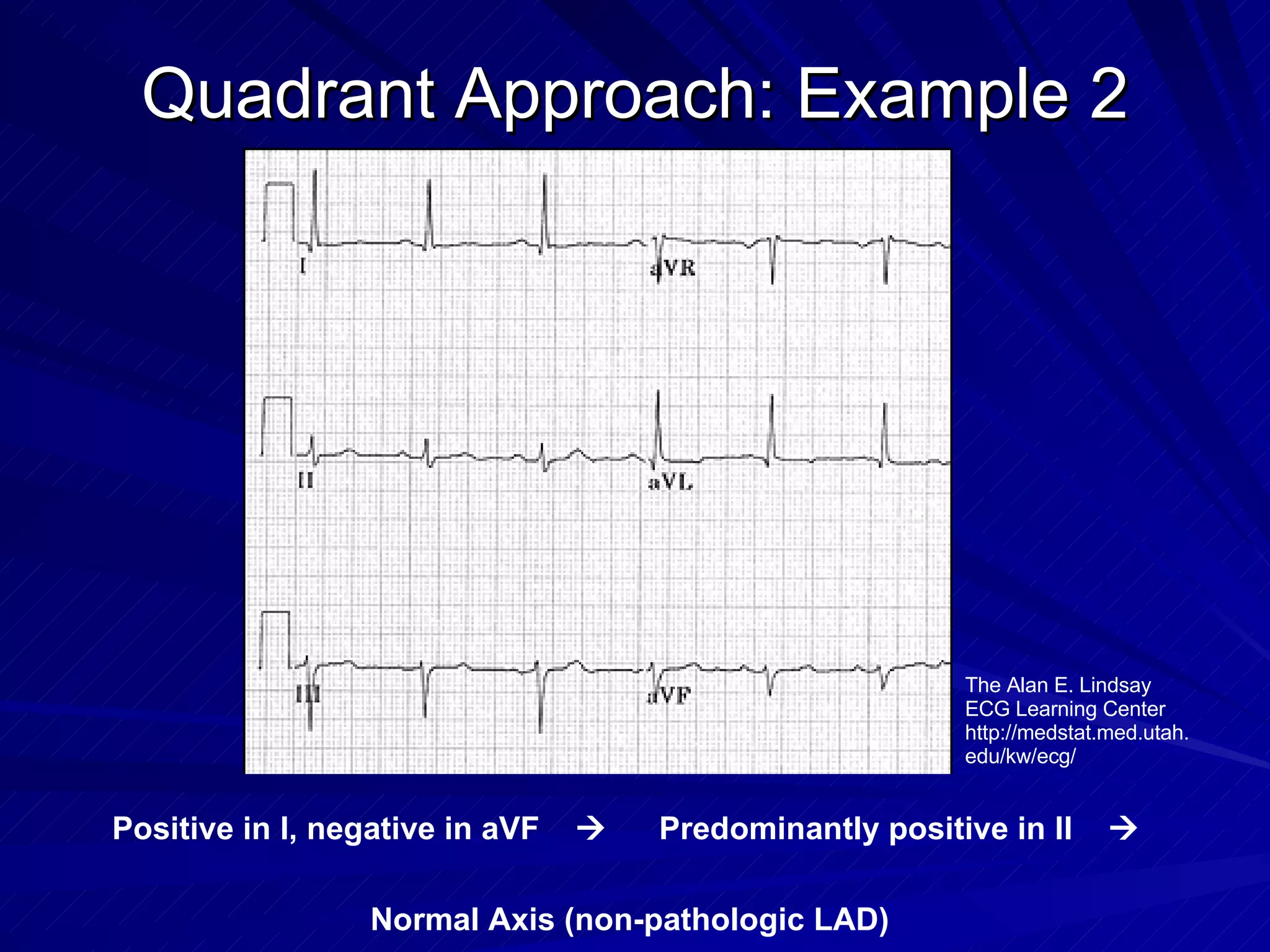 Ekg Basics Long | PPT