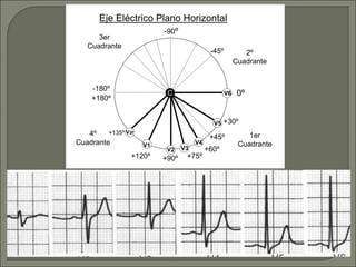 EKG - Eje electrico | PPT