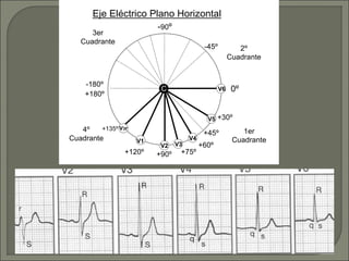 EKG - Eje electrico | PPT