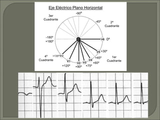EKG - Eje electrico | PPT