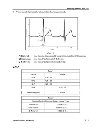 Ekg lab 3 | PDF