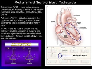 EKG Module | PPT