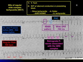 EKG Module | PPT