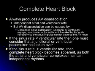EKG Module | PPT