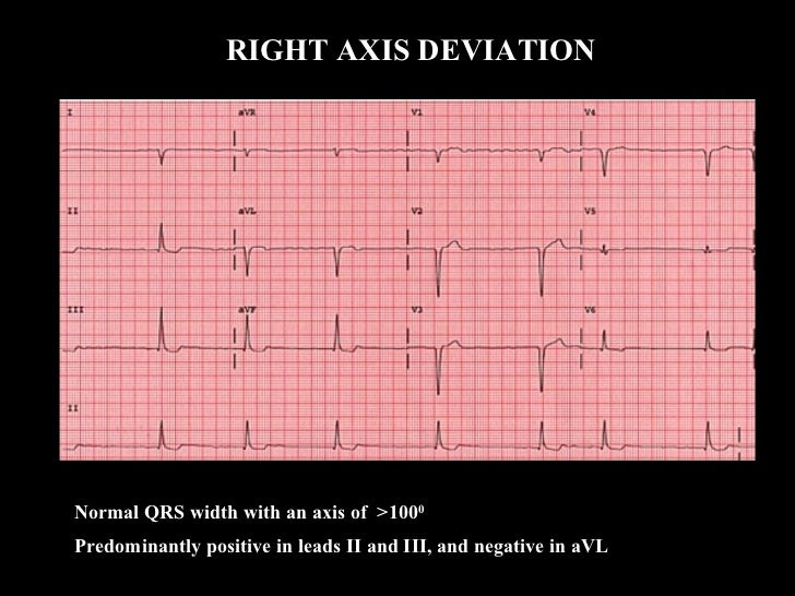 Ekg Tutorial