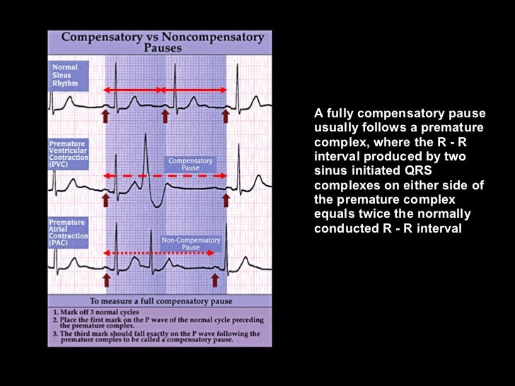 Ekg Tutorial
