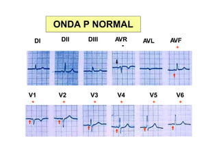 EKG 1 (1).pptx
