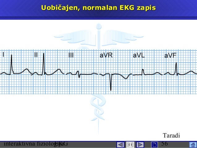 Jasika Milan Rakic Interpretacija Ekg A Milan Rakic, Iskrena Pesma