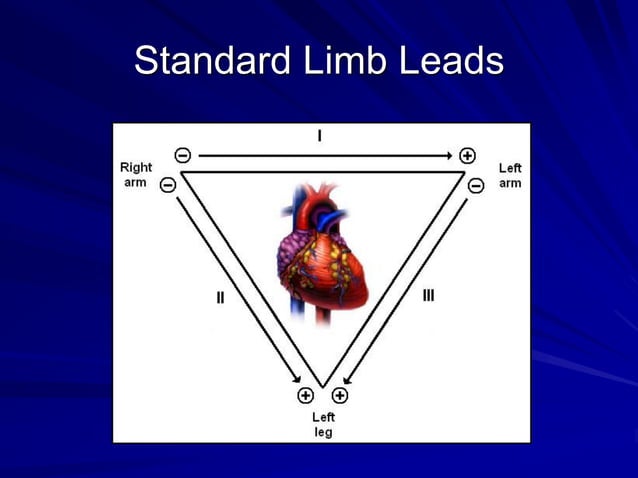 EKG Basics - Long.pdf | Free Download