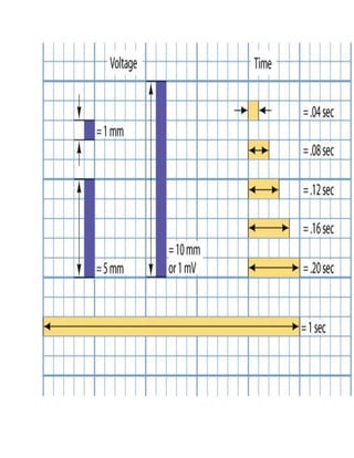 Ekg boxes | DOCX