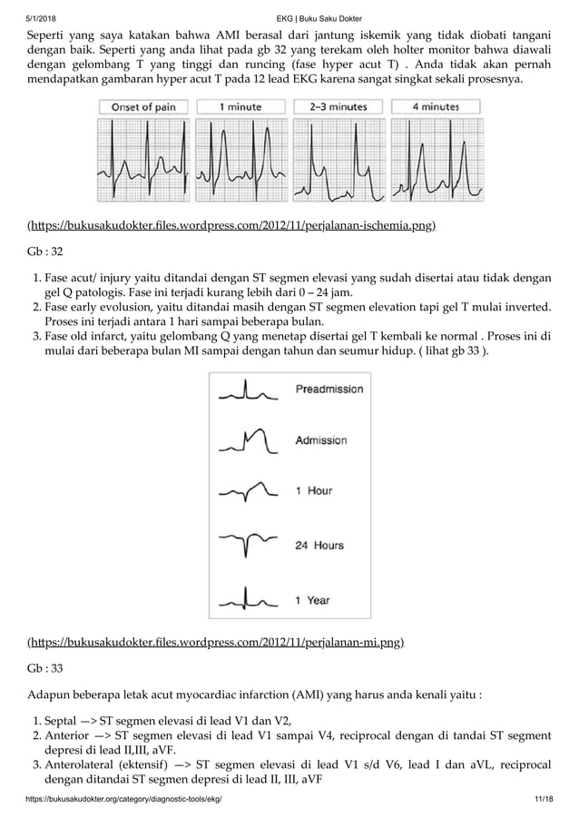 Ekg buku saku dokter | PDF